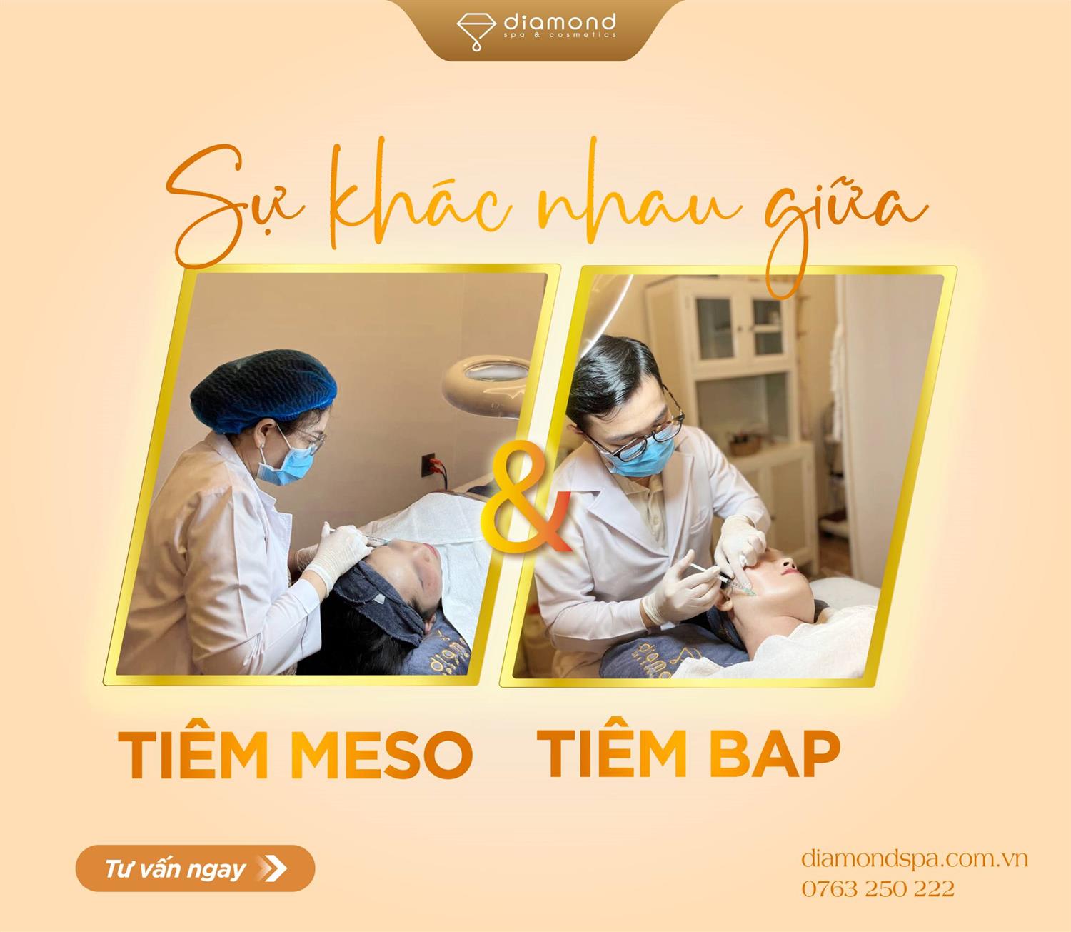 SỰ KHÁC NHAU GIỮA TIÊM MESO VÀ TIÊM BAP